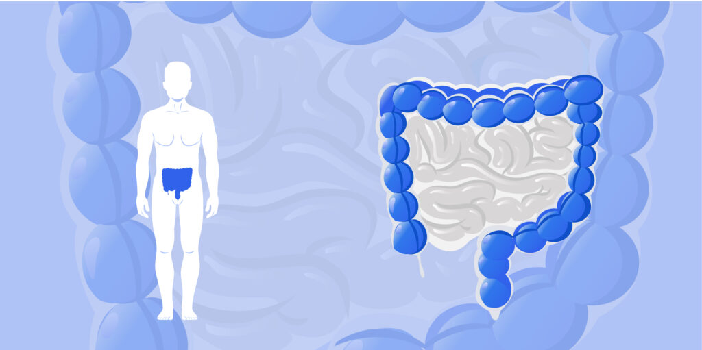 Operacije debelog creva – SAVA SURGERY