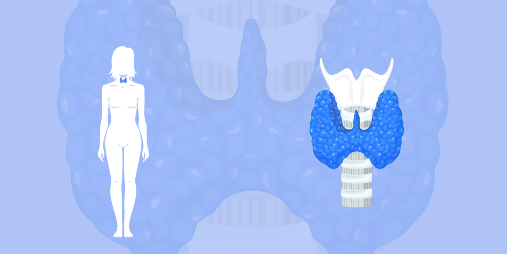 Operacije štitaste žlezde – SAVA SURGERY