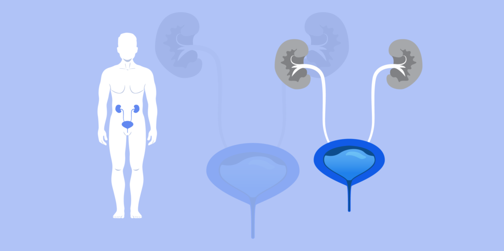 Operacije bešike – SAVA SURGERY